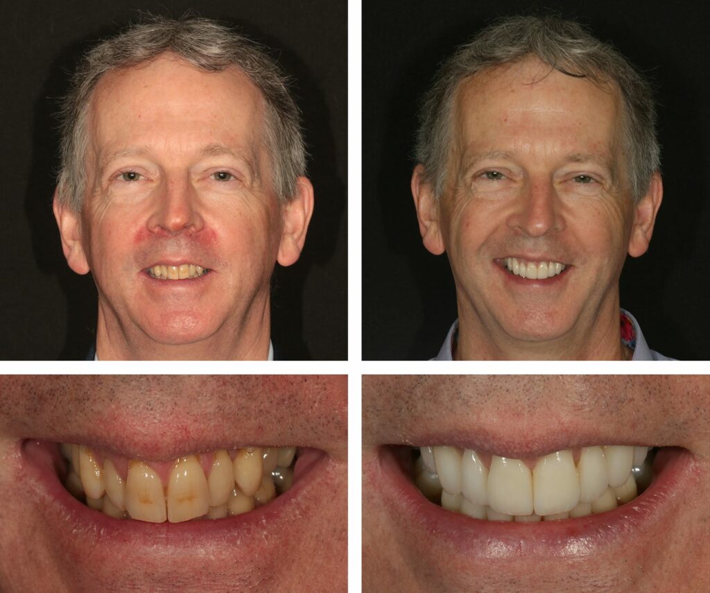 Patient Stories - Central London W1, UK - Harley Street Dental Studio